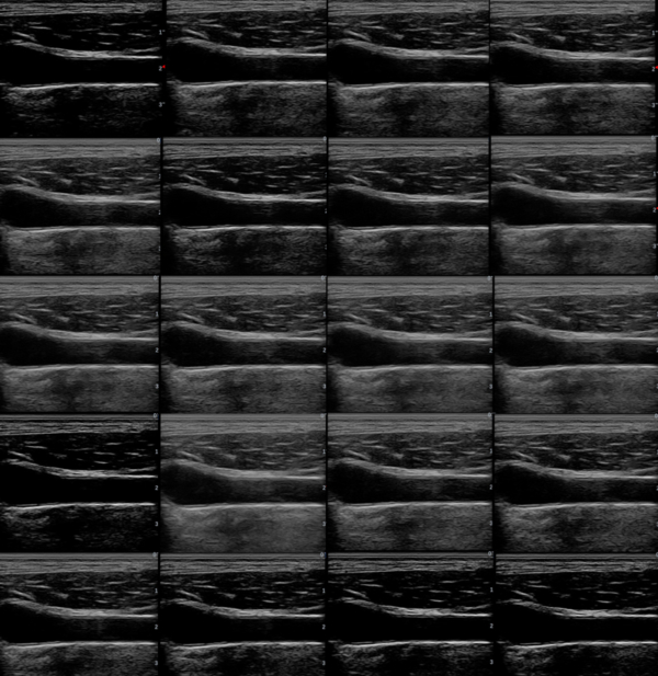 Ultrasound Imaging Guide - Probo Medical UK