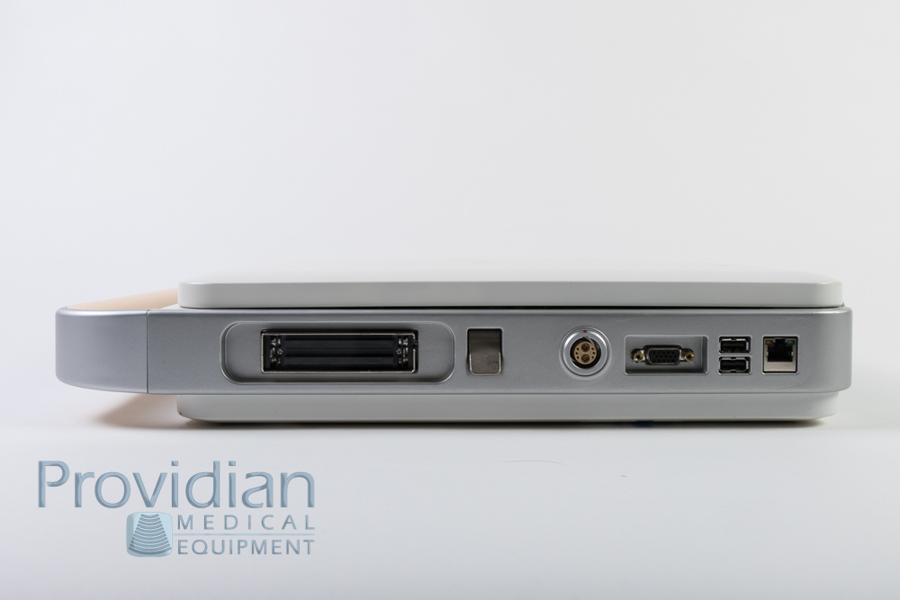 Philips CX50 Portable Ultrasound Review - Probo Medical UK