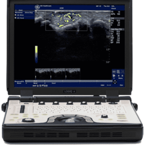 GE HealthCare NextGen LOGIQ e - Probo Medical UK