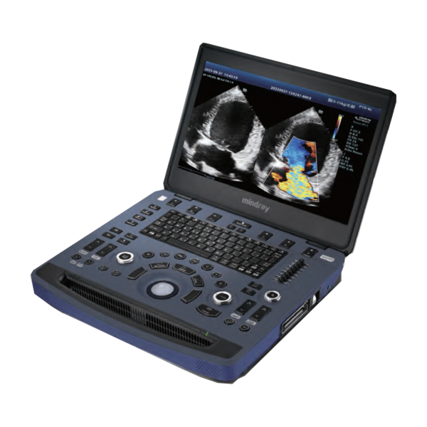 Mindray Vetus M11 - Probo Medical UK